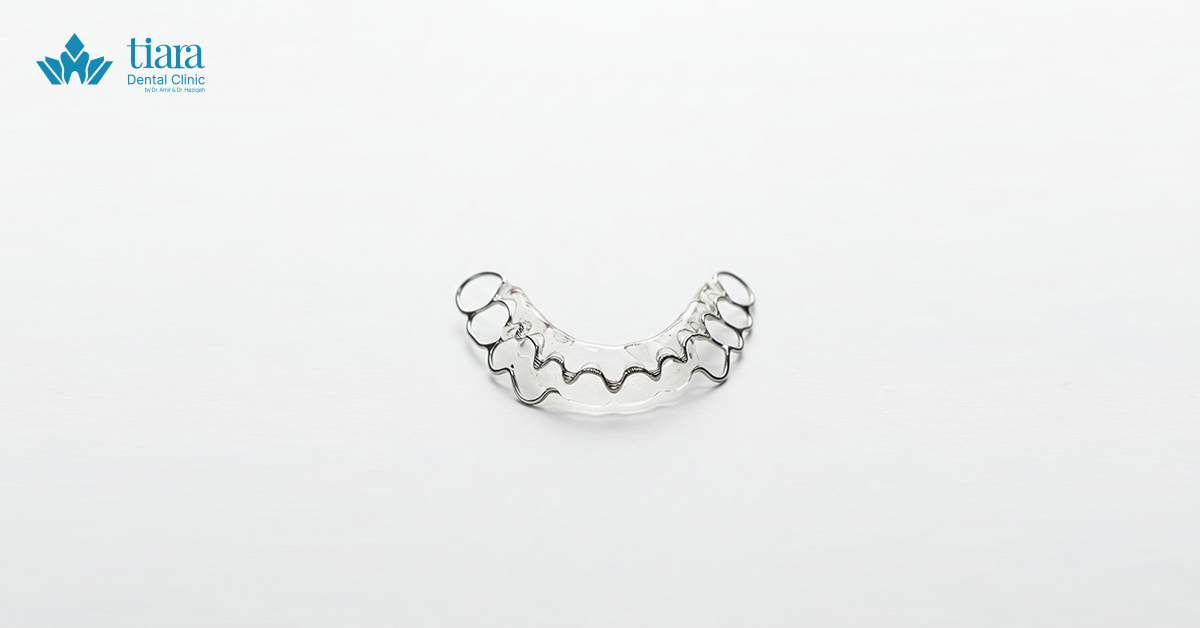 Hawley Retainer – Tiara Dental