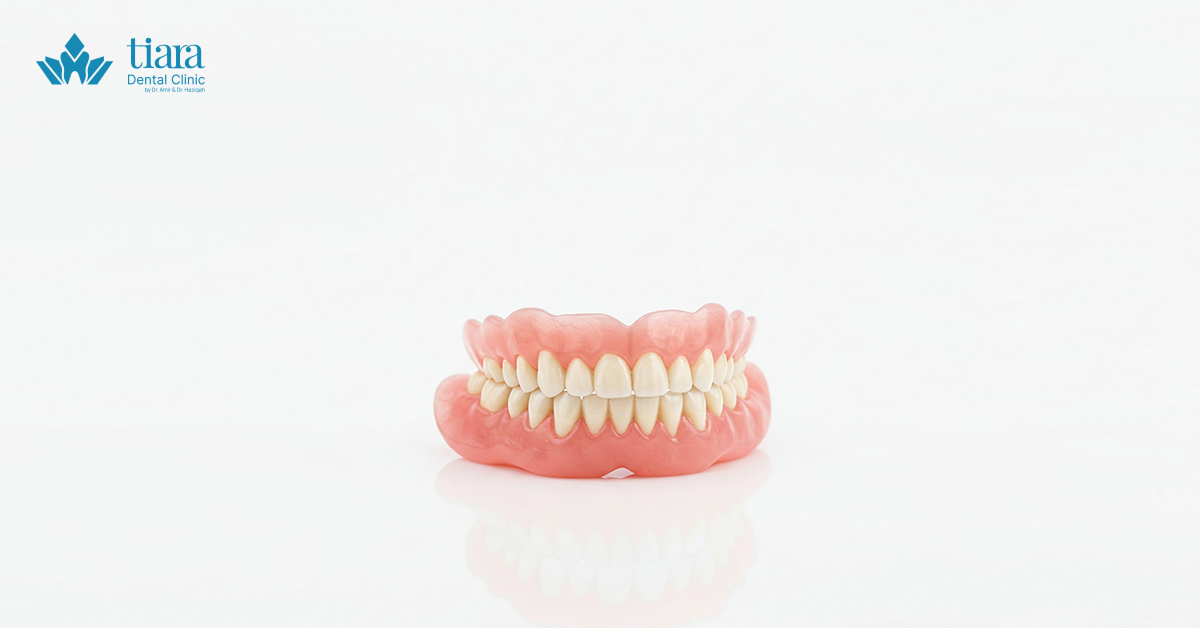 Internal Bleaching Siap 30 Min | Tiara Dental Shah Alam