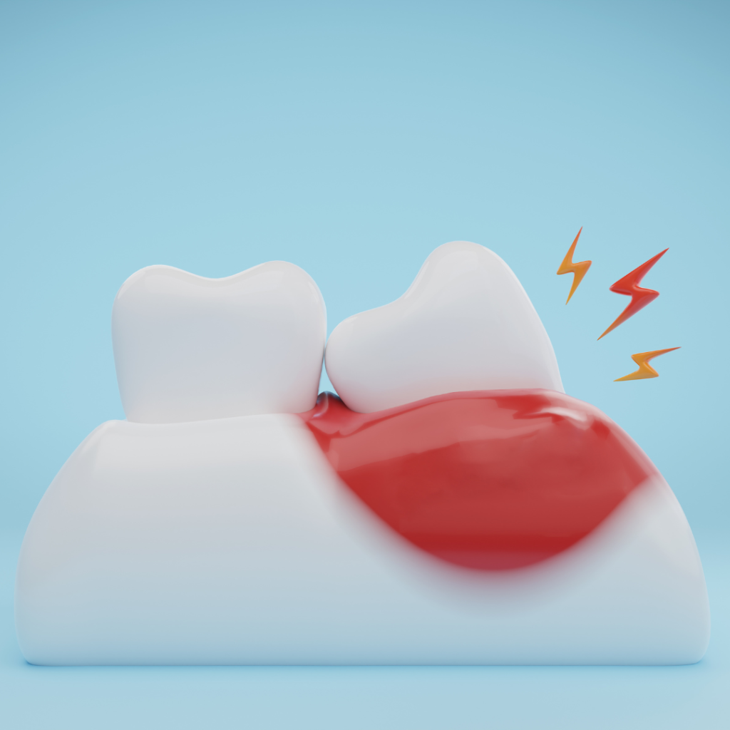 Rawatan Akar Gigi Geraham, Kacip & Taring (Prosedur LENGKAP) – Tiara Dental
